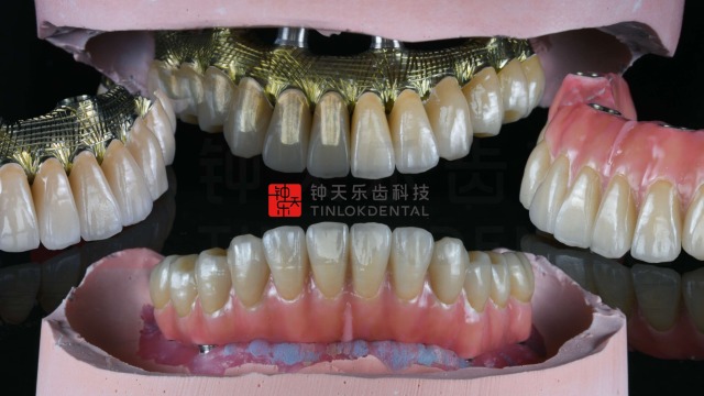 Products | Tinlokdental