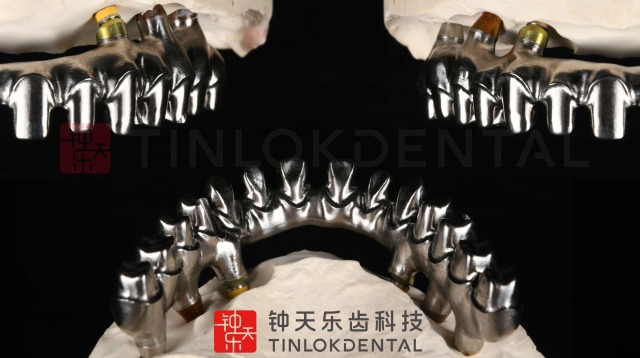 Products | Tinlokdental