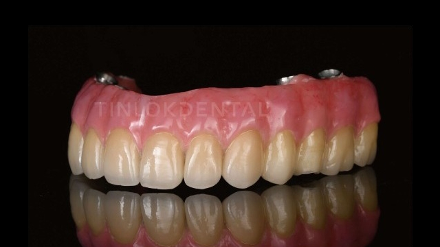 Products | Tinlokdental